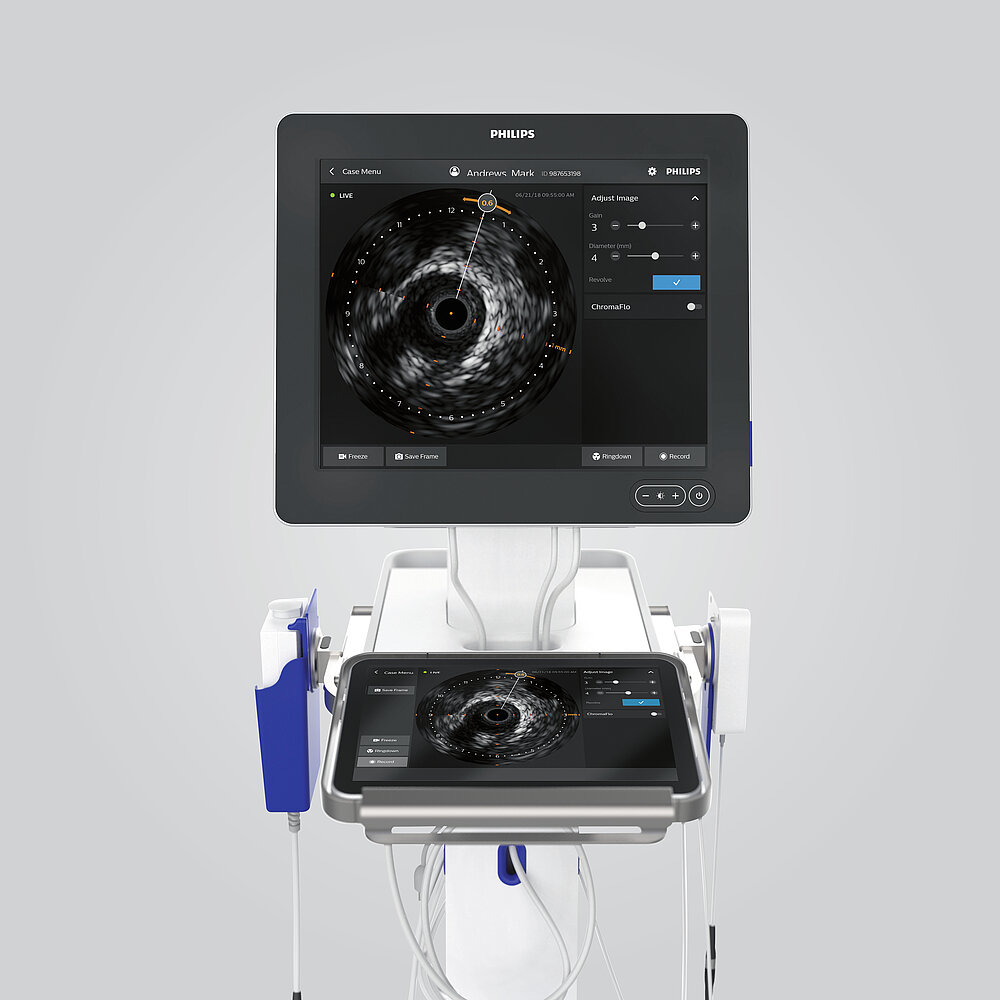 Red Dot Design Award: Philips IntraSight