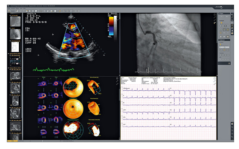 Red Dot Design Award: JiveX 5
