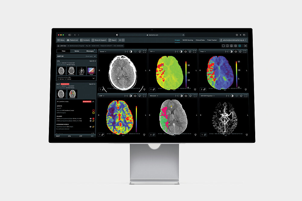 Red Dot Design Award: Brainomix 360