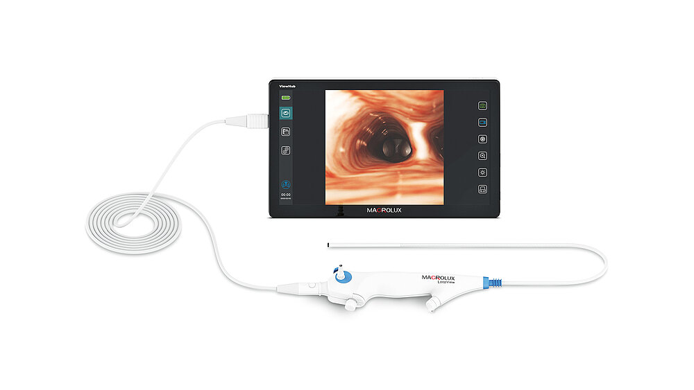 Red Dot Design Award: LoopView® Single-Use Digital Flexible Bronchoscope