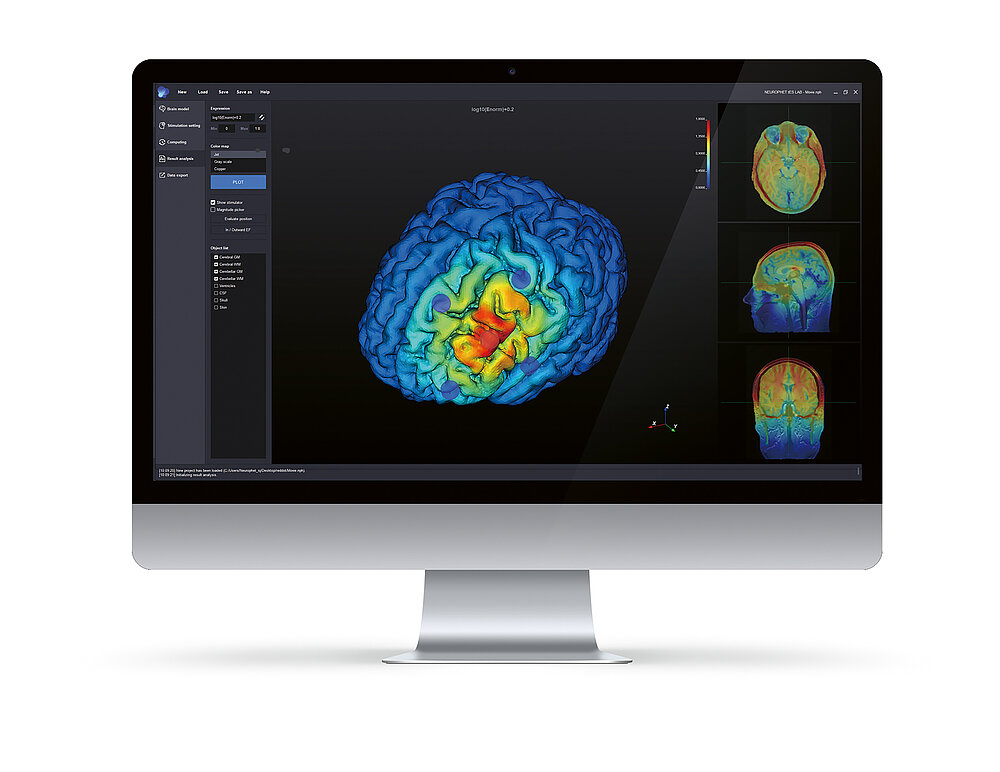 Red Dot Design Award: NEUROPHET tES LAB 1.0