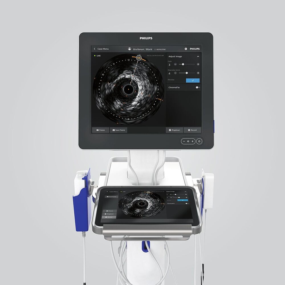 Red Dot Design Award: Philips IntraSight